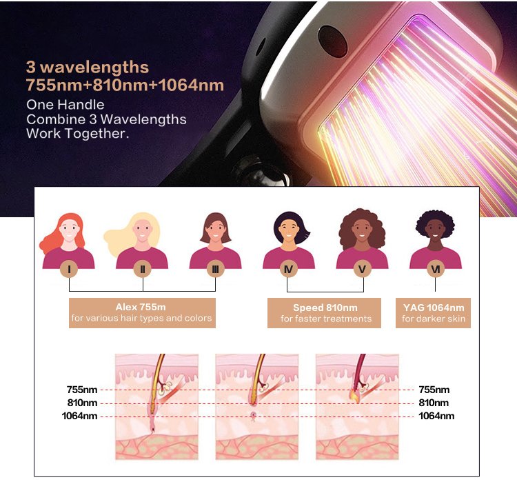 Professional Titanium Laser Hair Removal – lfbeautylaser